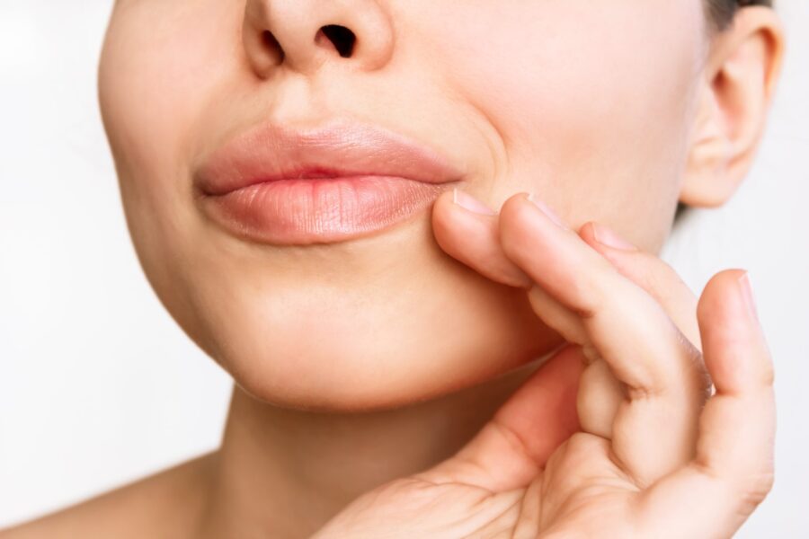 Drooping Mouth Corners | Metropolitan Skin Clinic