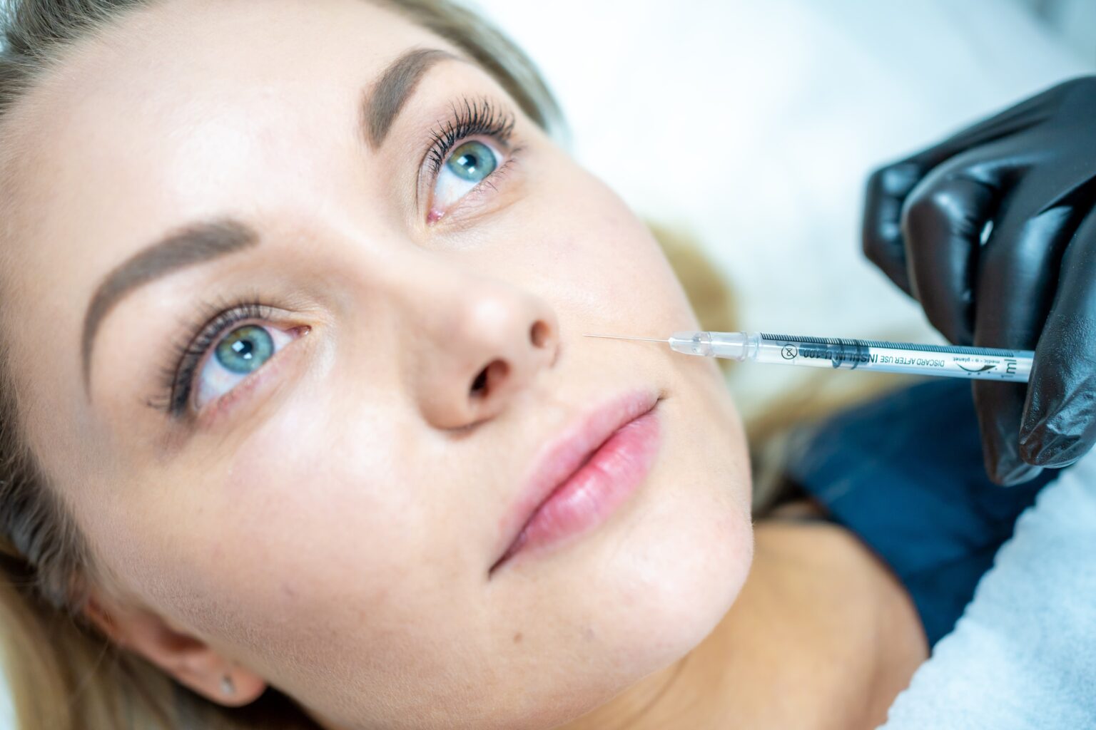 Drooping Mouth Corners | Metropolitan Skin Clinic