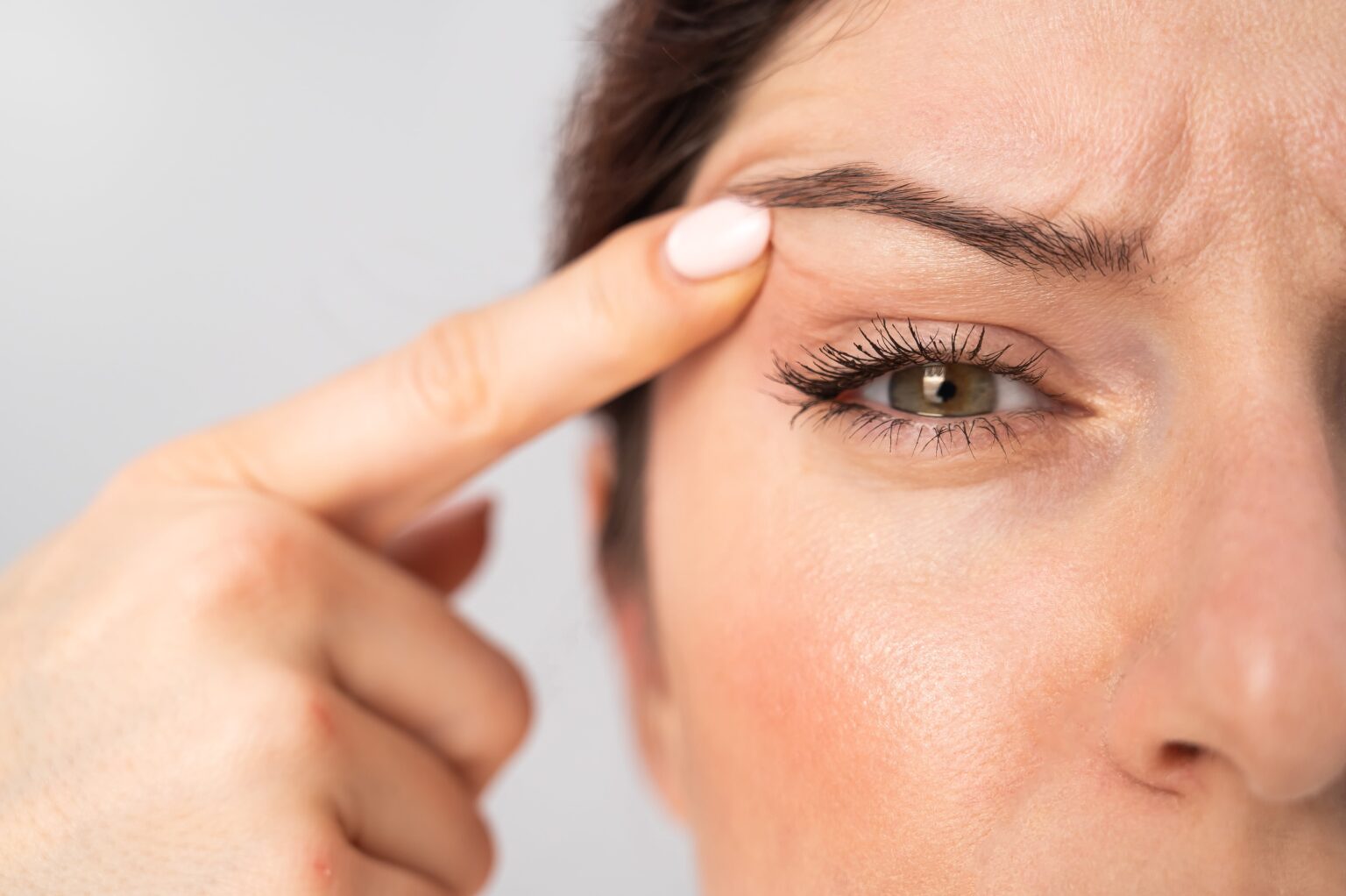 Non-Surgical Treatment for Hooded Eyelids & Droopy Eyelids in ...